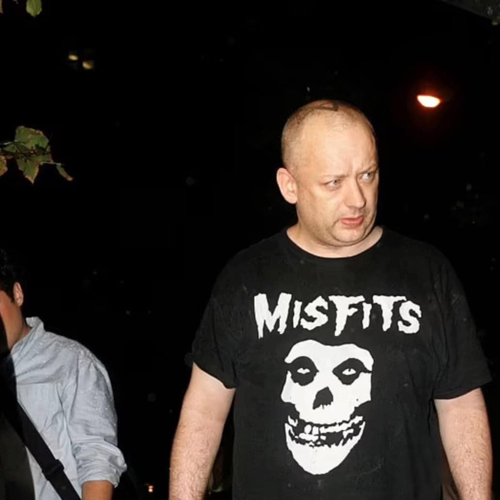 Boy George Hair Transplant - Harley Street HTC