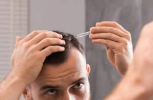 Topical Finasteride for Hair Loss - Benefits & Effectiveness